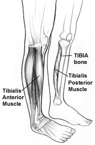 shinsplints - Boulder Therapeutics